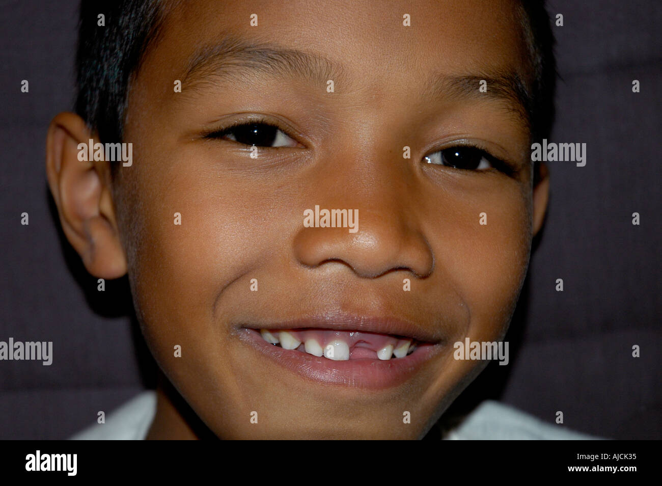 boy wisdom tooth Stock Photo - Alamy