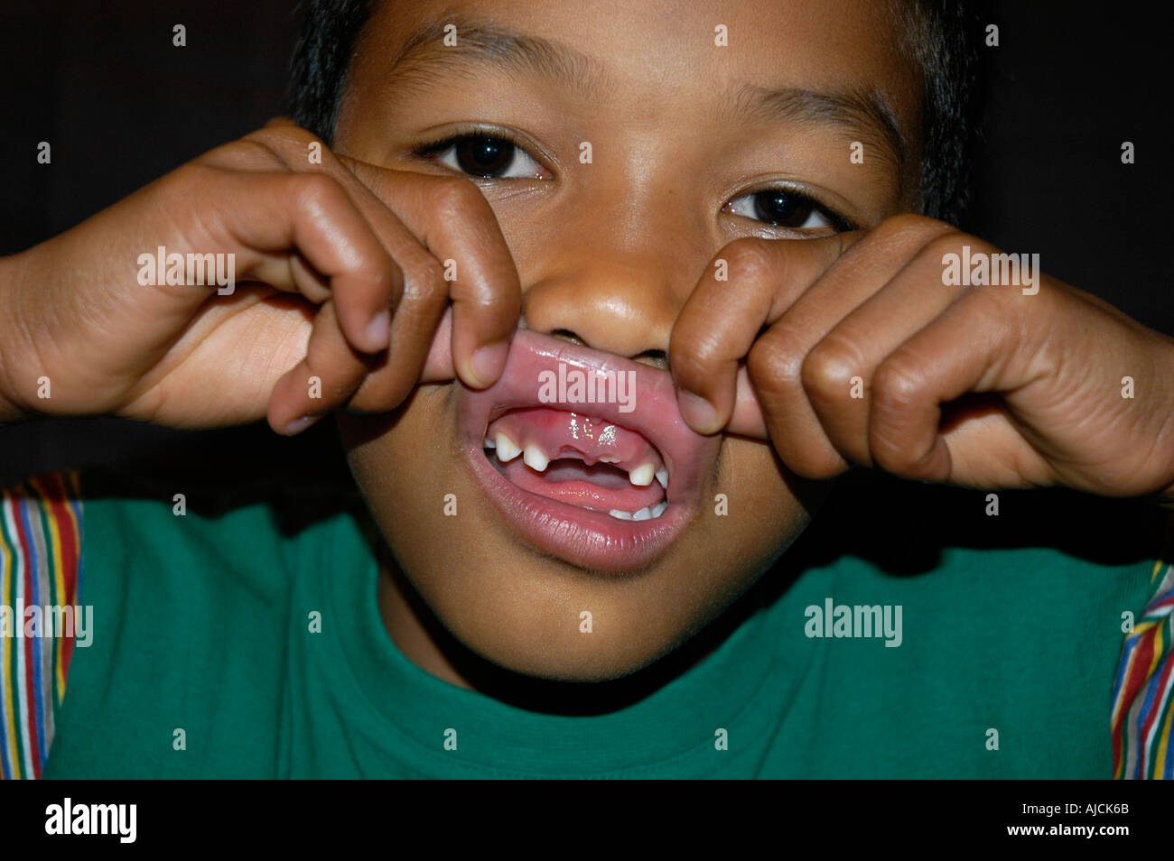 Tooth healt hi-res stock photography and images - Alamy