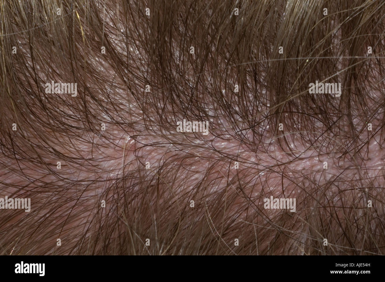 Close Up Of Hair On Top Of Head Stock Photo - Alamy