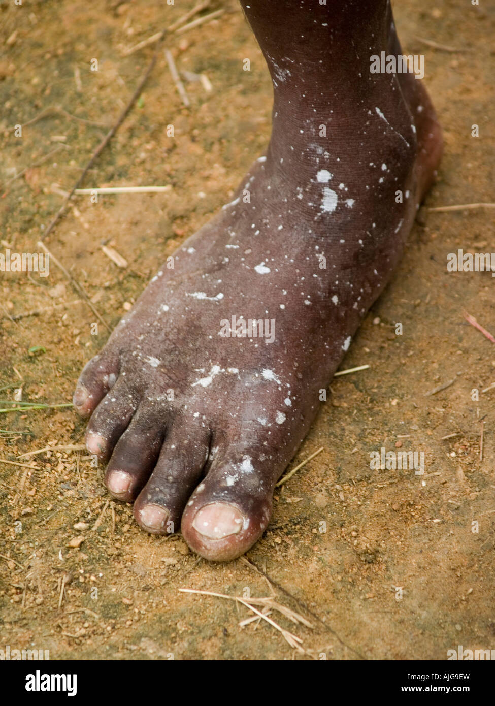 Farm laborers bare foot Stock Photo - Alamy