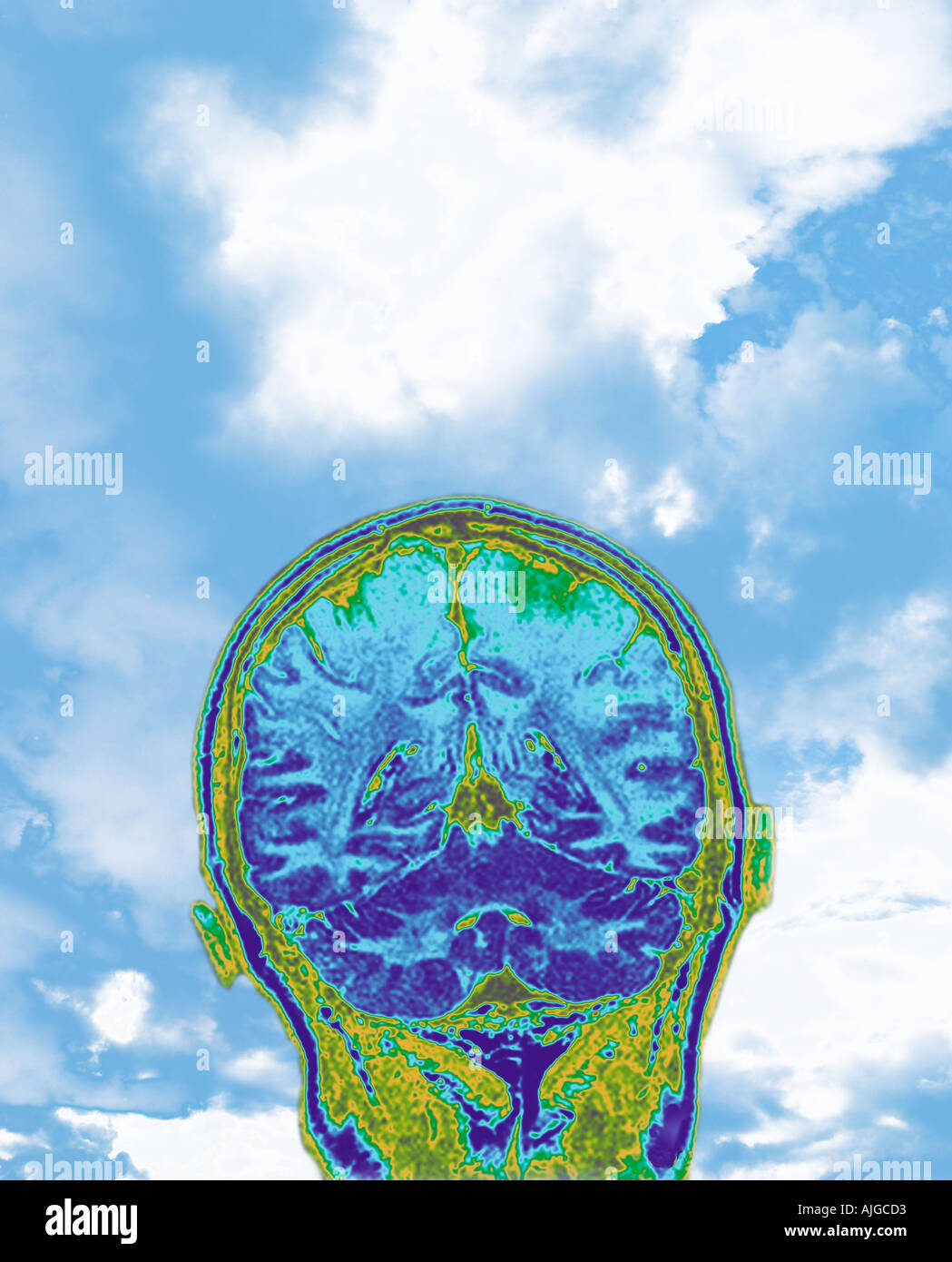 Magnetic resonance imaging (MRI) of a section through a human head ...