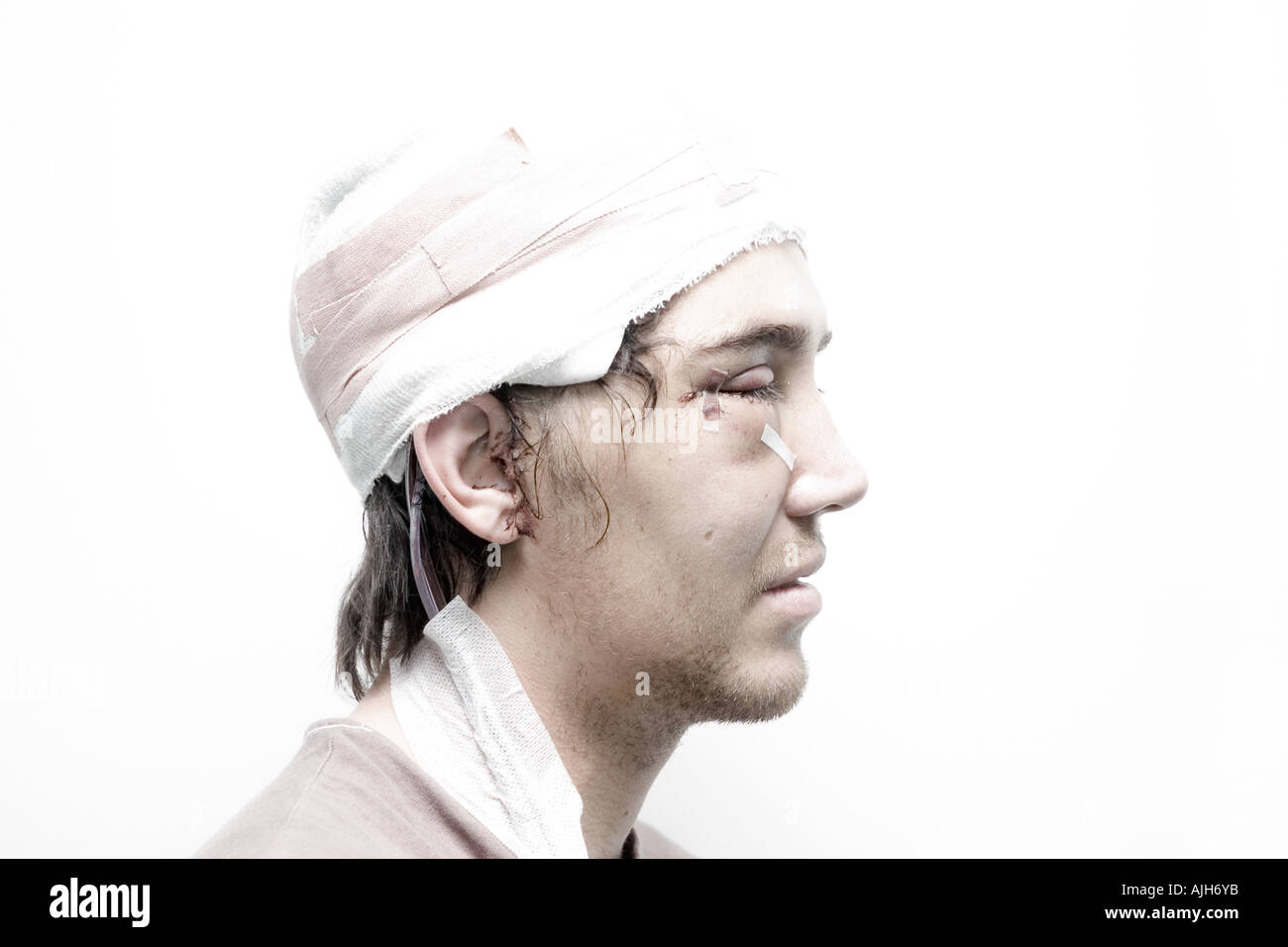 Surgery wounds stiching hi-res stock photography and images - Alamy