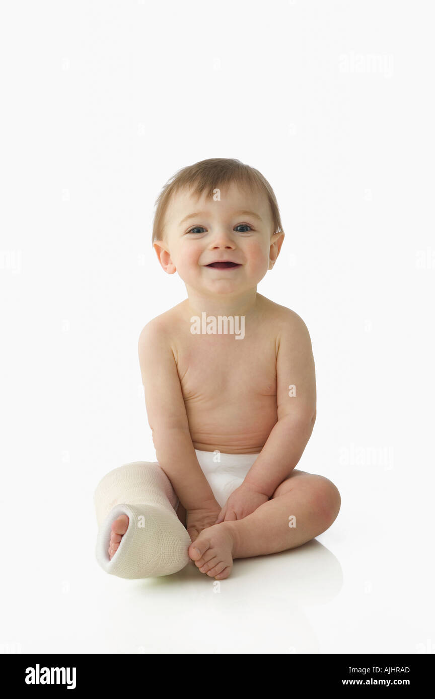 Baby with leg in plaster Stock Photo - Alamy