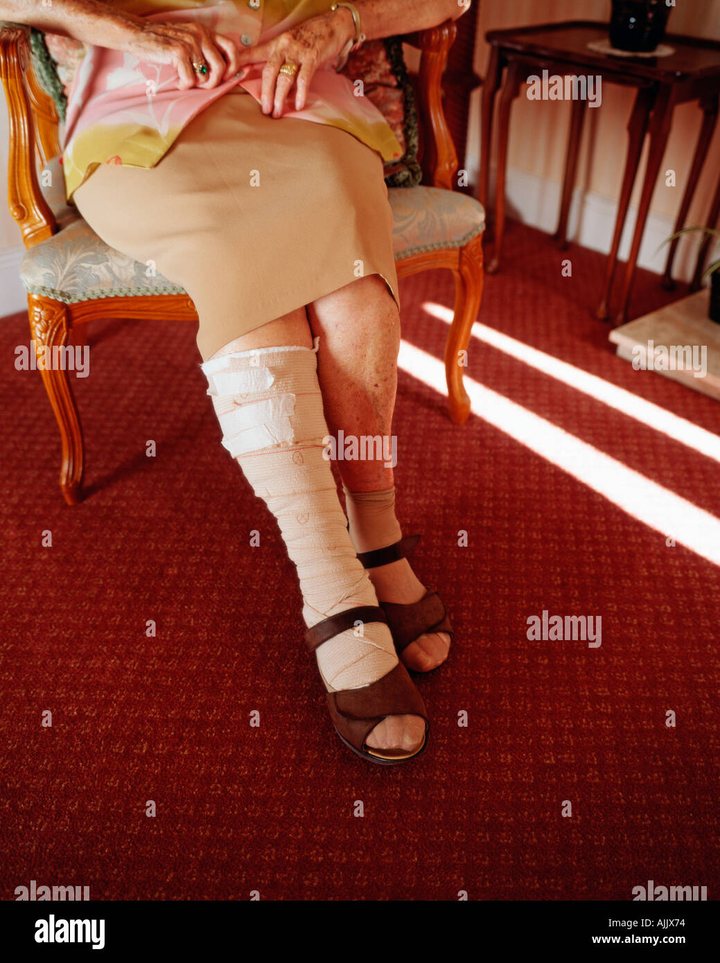 Elderly woman with bandaged leg Stock Photo - Alamy