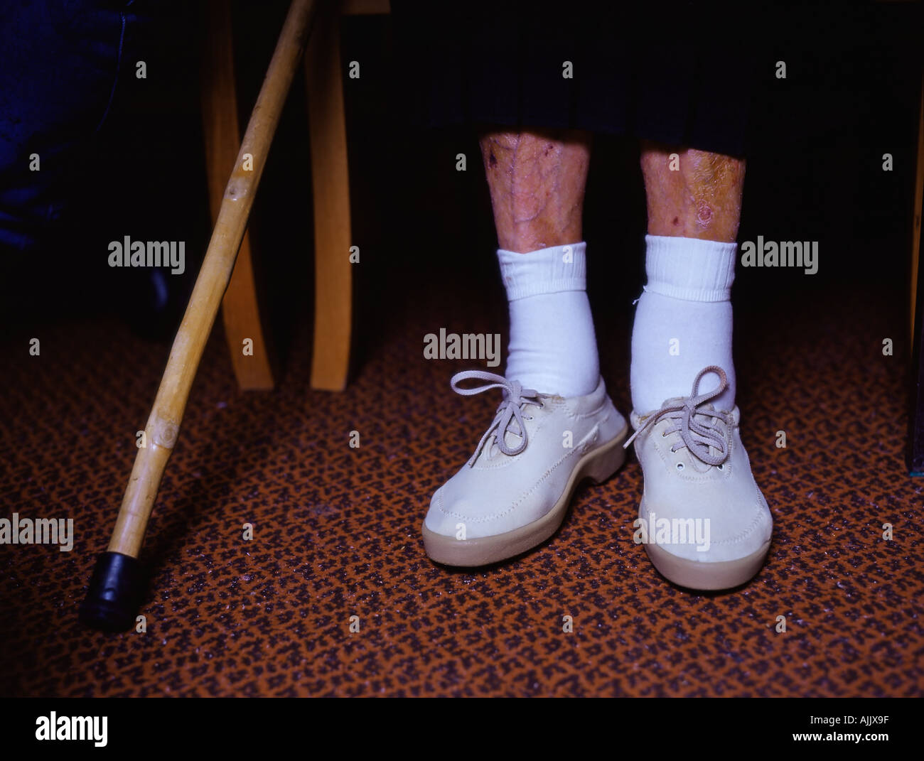 Swollen legs hi-res stock photography and images - Alamy