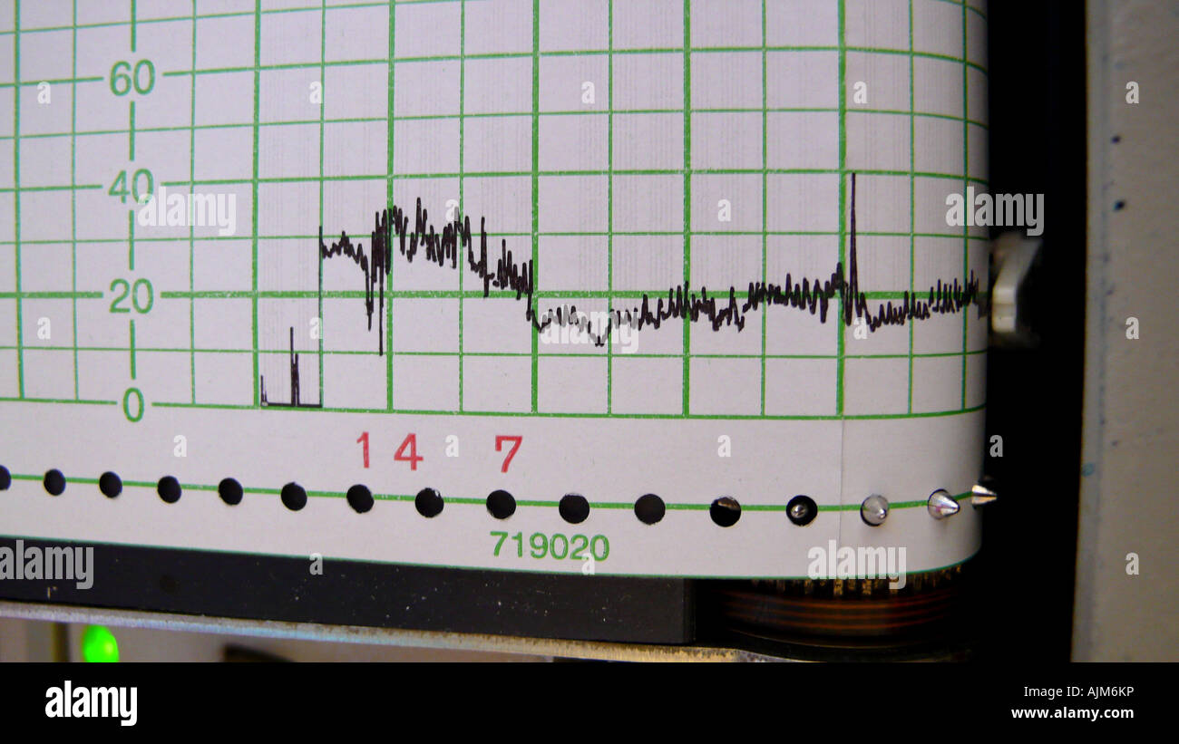 Cardiotocograph Stock Photos & Cardiotocograph Stock Images - Alamy