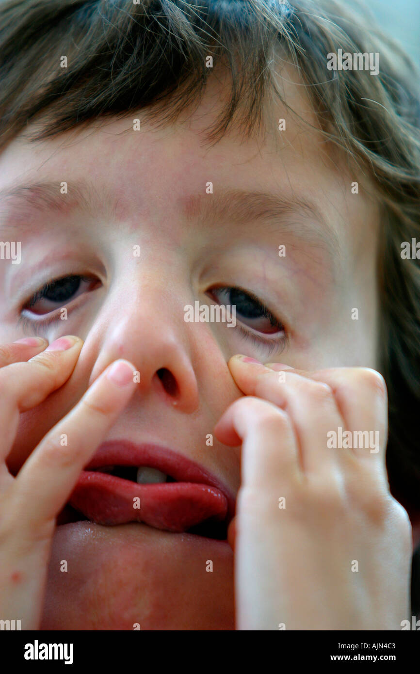 BOY PULLING A FACE Stock Photo - Alamy