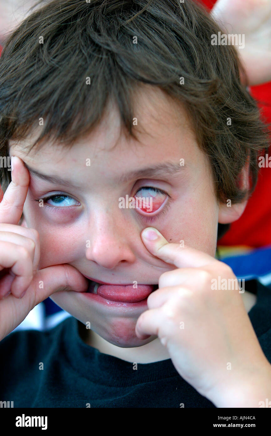 BOY PULLING A FACE Stock Photo - Alamy