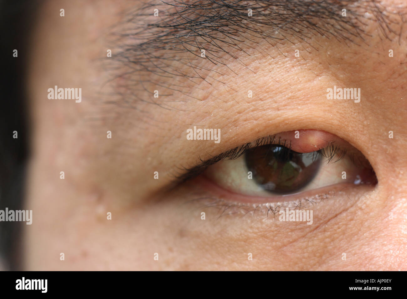 Stye eye hi-res stock photography and images - Alamy
