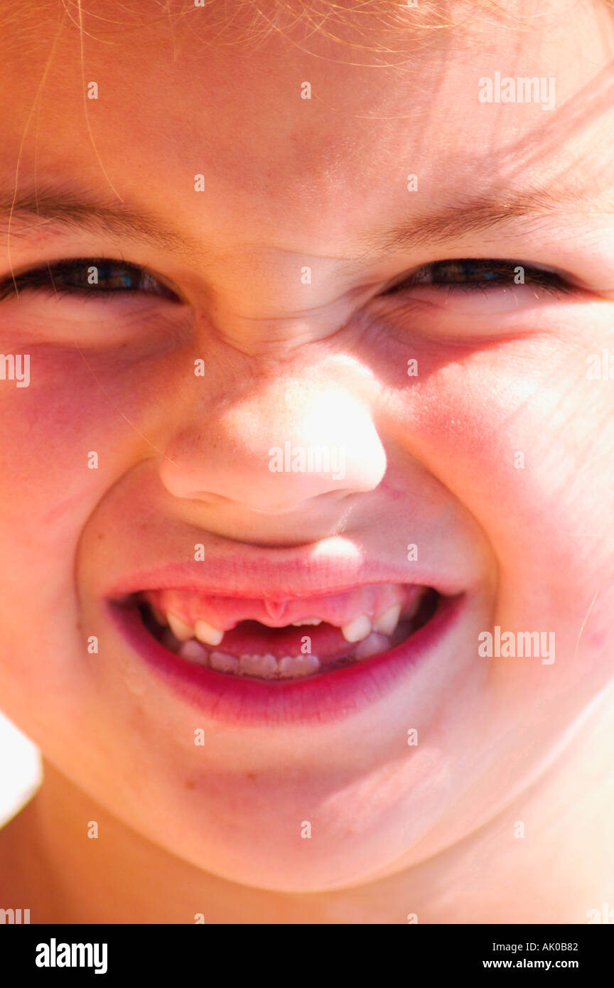 girl with missing teeth Stock Photo - Alamy