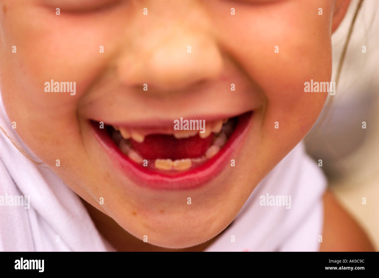 missing tooth smile Stock Photo - Alamy