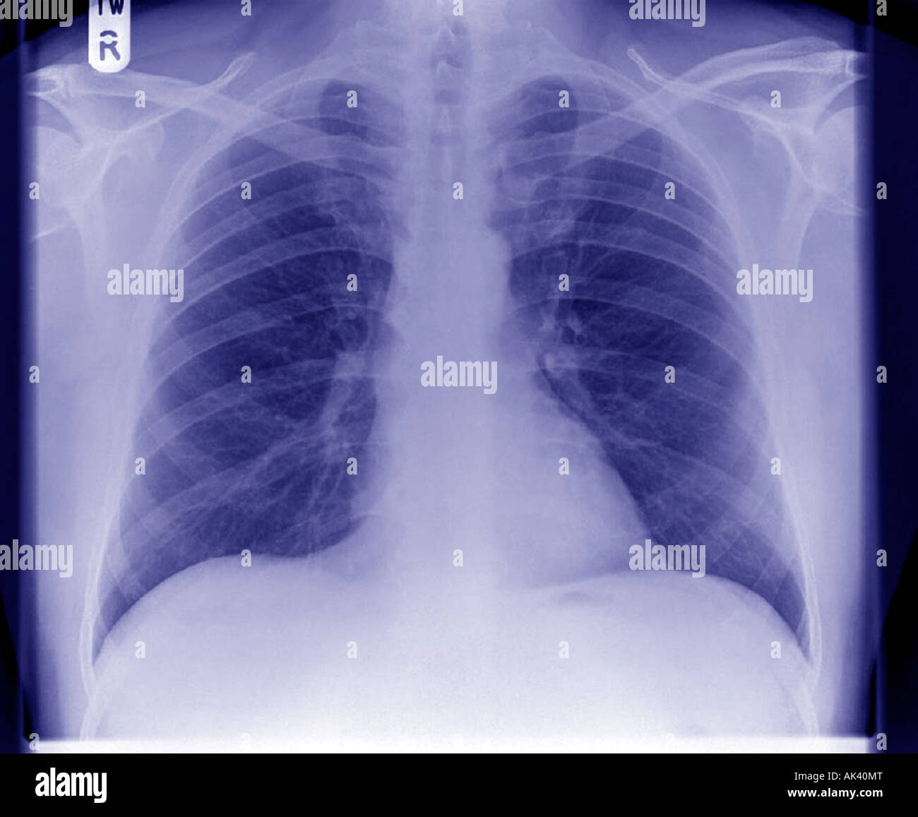 Male chest bones hi-res stock photography and images - Alamy