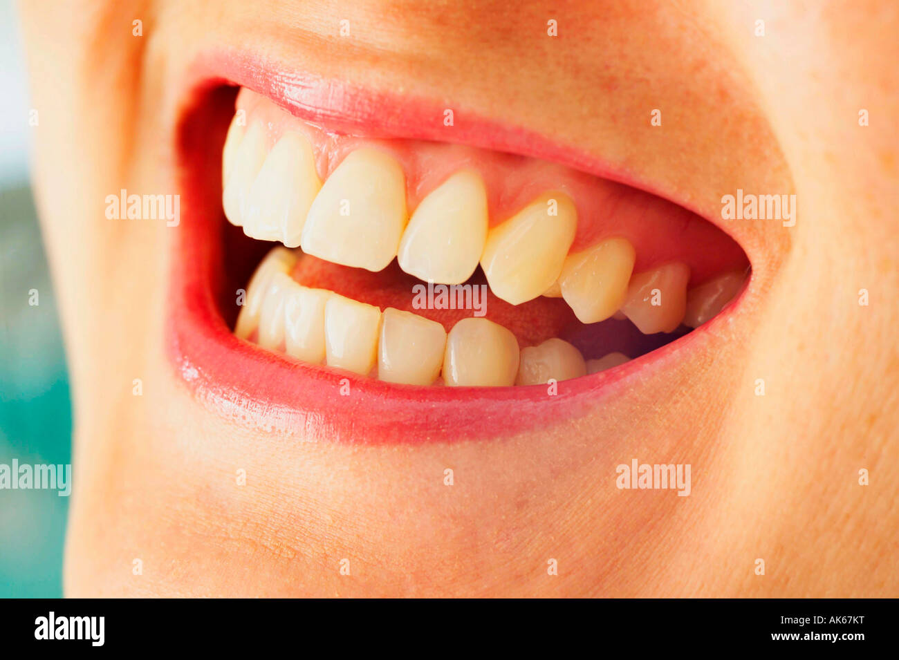 Teeth of a woman Stock Photo - Alamy