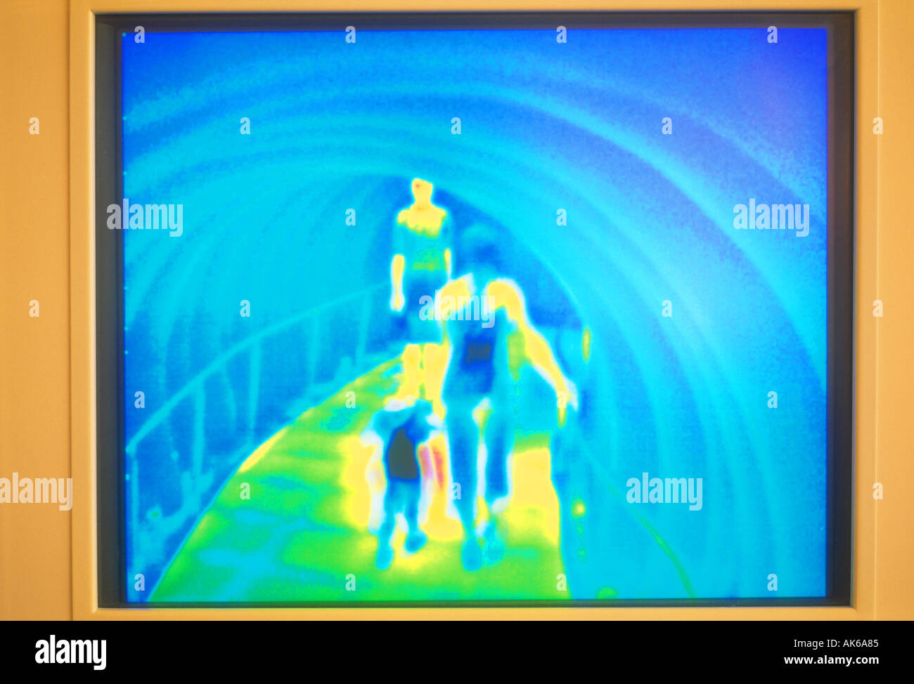 Skin conduction hi-res stock photography and images - Alamy