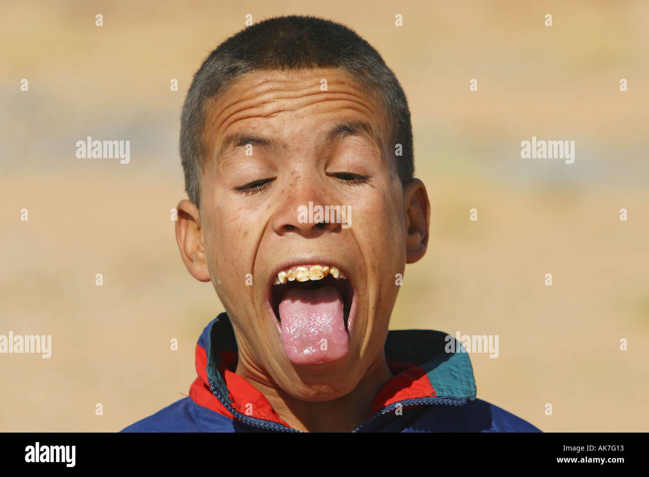 Tongue plaque hi-res stock photography and images - Alamy