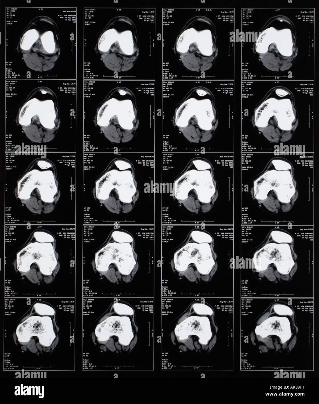 Diagnostics hi res hi-res stock photography and images - Alamy