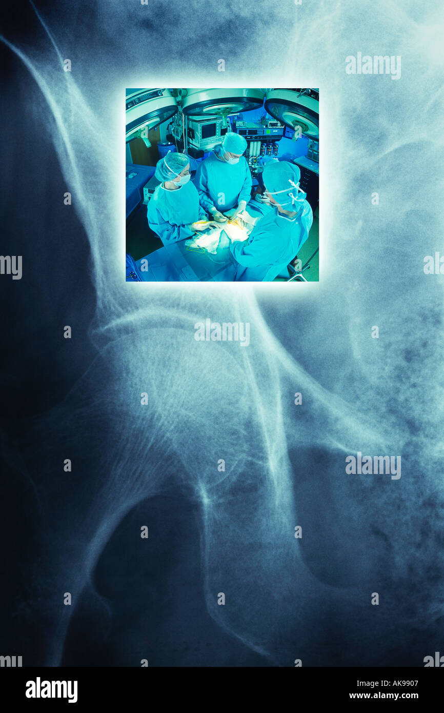 Surgery and X ray Stock Photo - Alamy