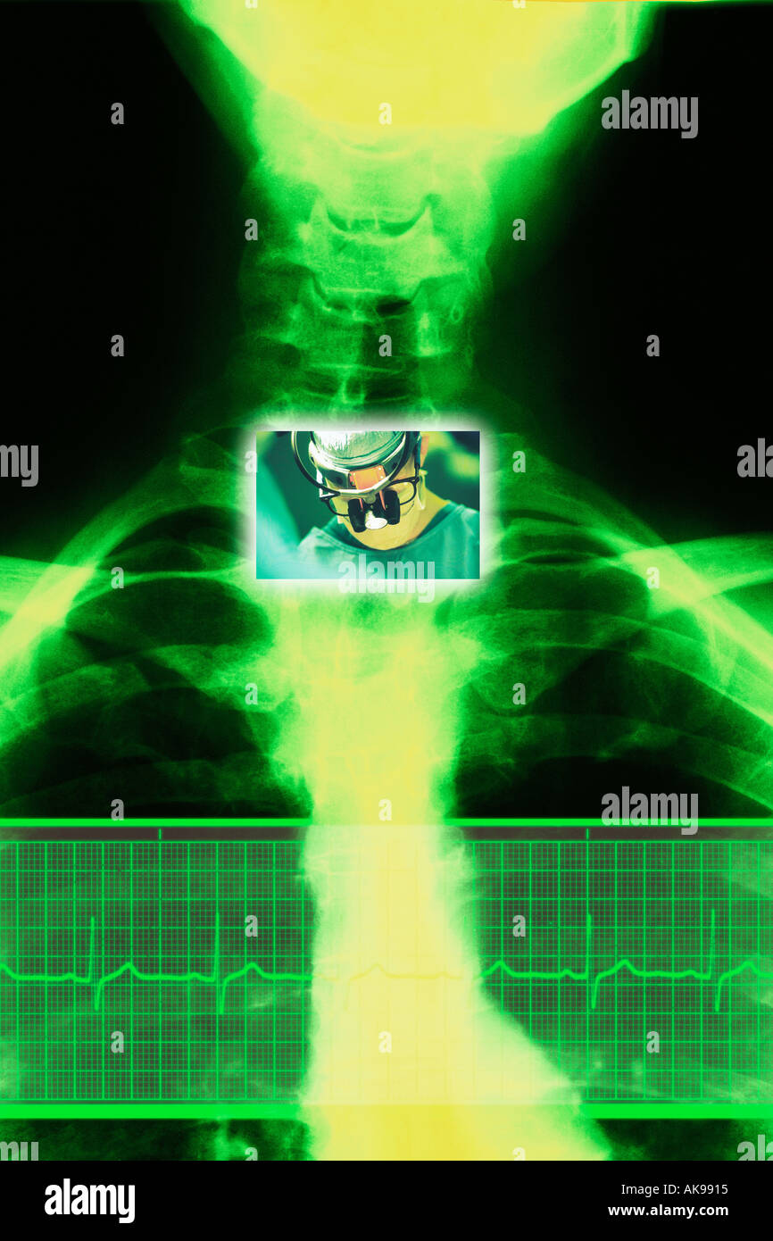 Neck Surgeon and Chart Stock Photo - Alamy