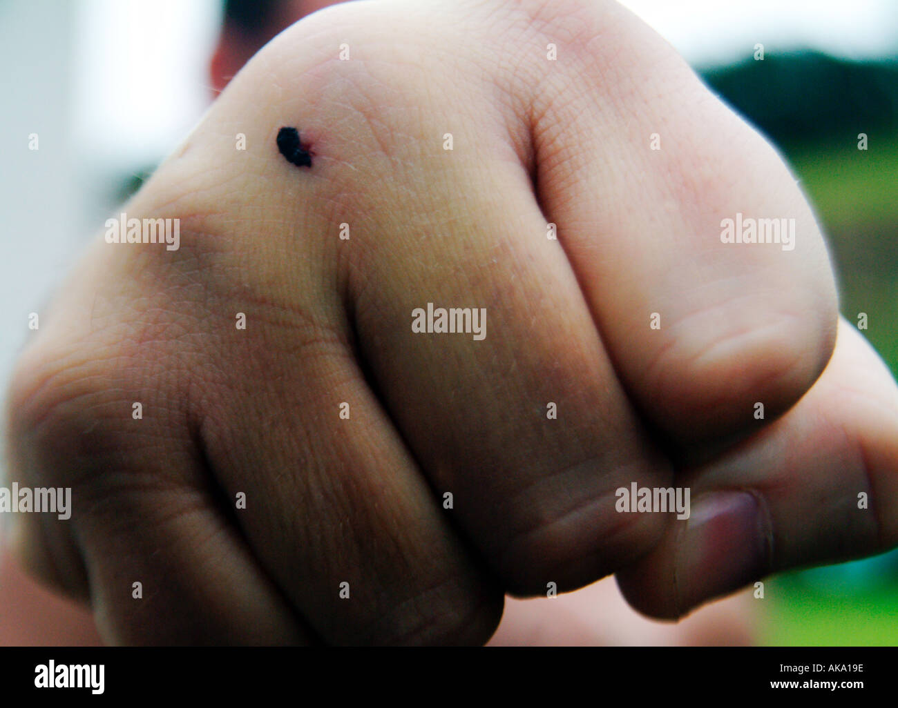 Bruised boxer hi-res stock photography and images - Alamy