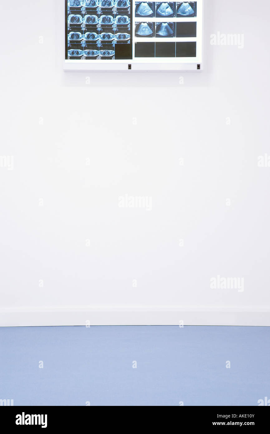 X rays on wall hi-res stock photography and images - Alamy