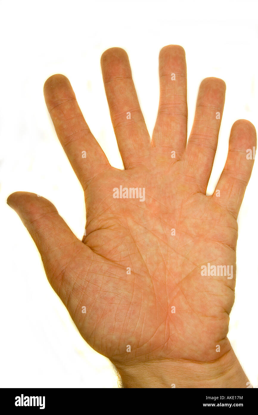 A stock photograph of A stock photograph of a man's palm with six ...