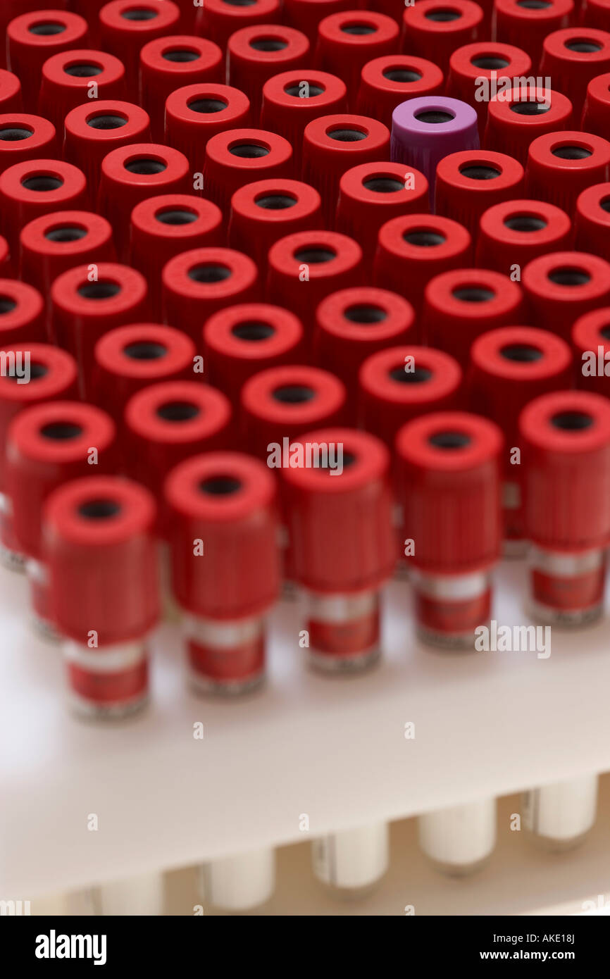 Test tubes with red lids surrounding one with purple lid Stock Photo ...