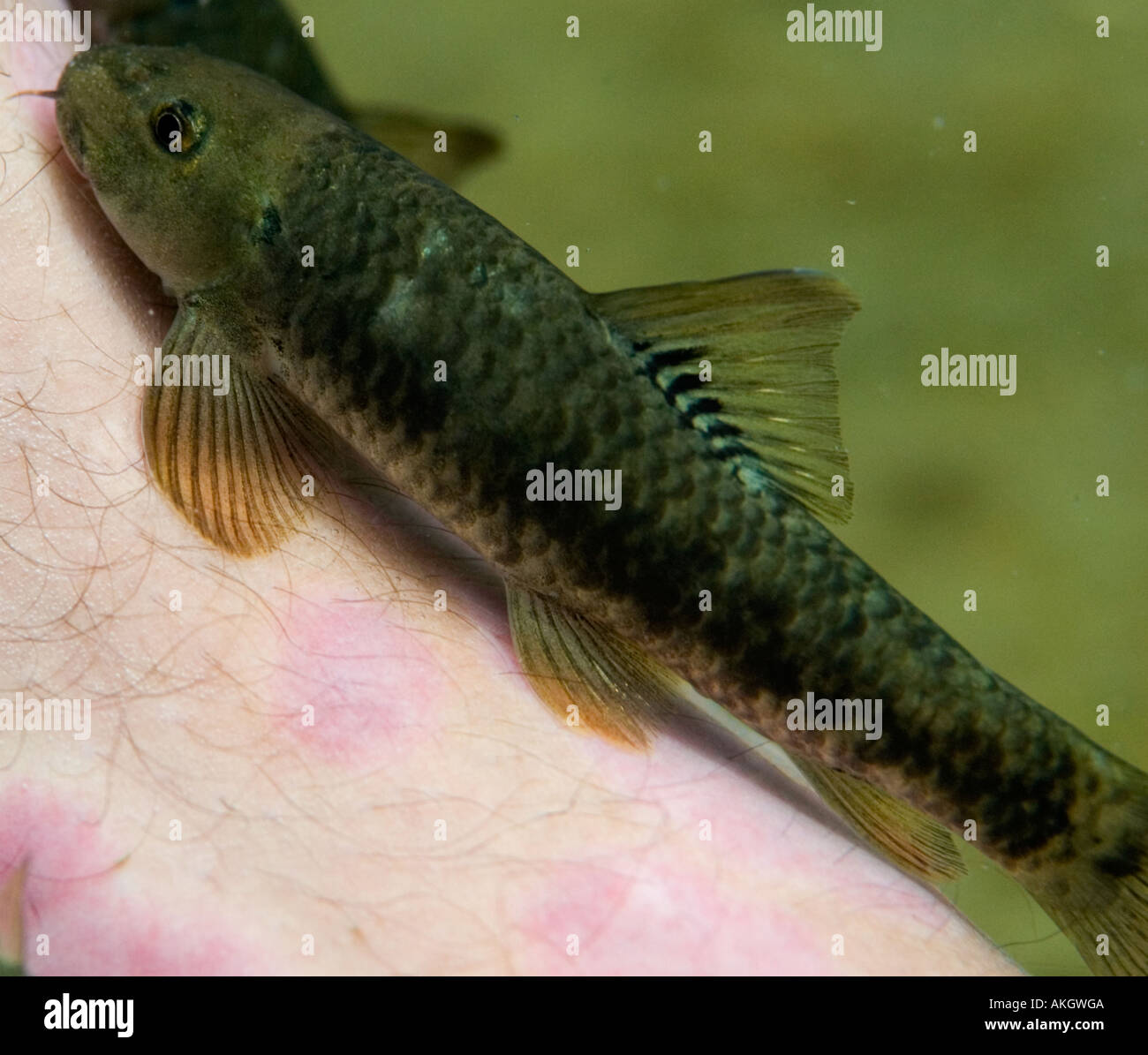 Fish Therapy Spa Kangal Central Anatolia Turkey A combination of ...