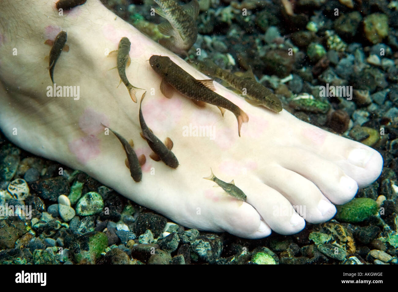 Fish Therapy Spa Kangal Central Anatolia Turkey A combination of ...