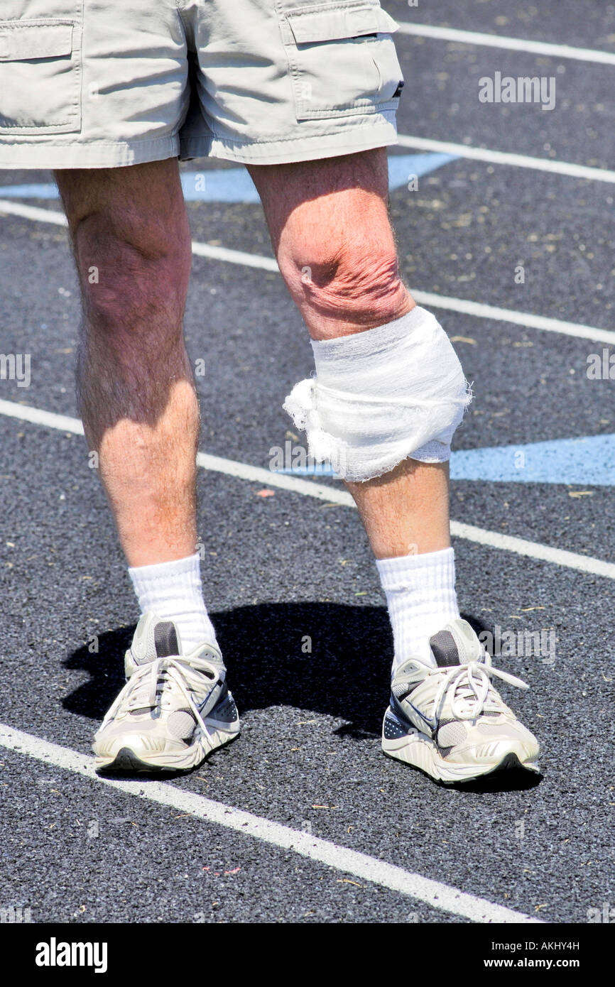 Bandaged leg injury close hi-res stock photography and images - Alamy