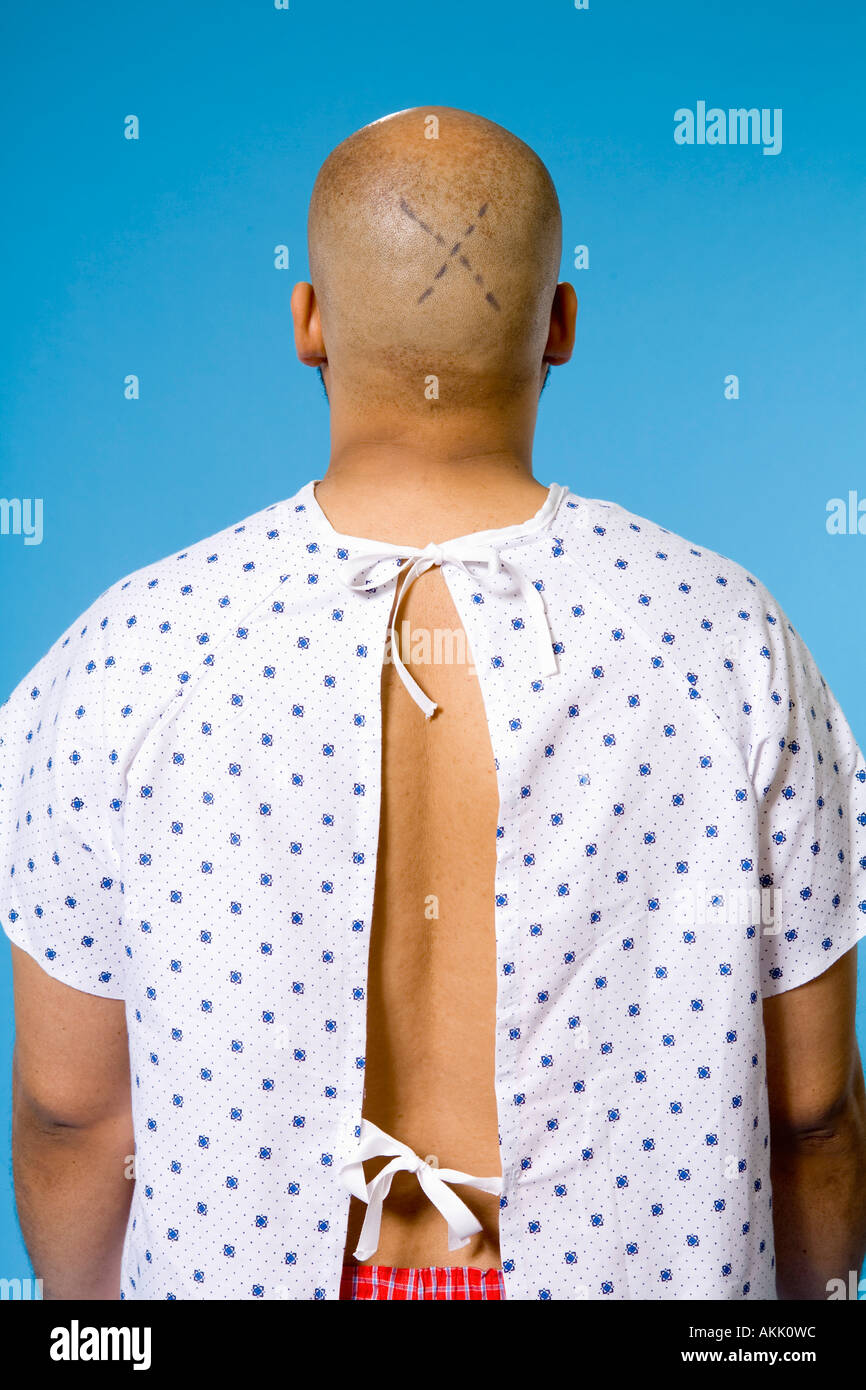 Rear view of male patient with X on head Stock Photo - Alamy