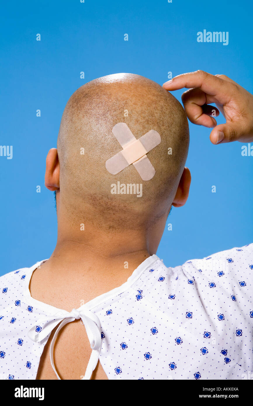 Male patient with bandages on head Stock Photo - Alamy