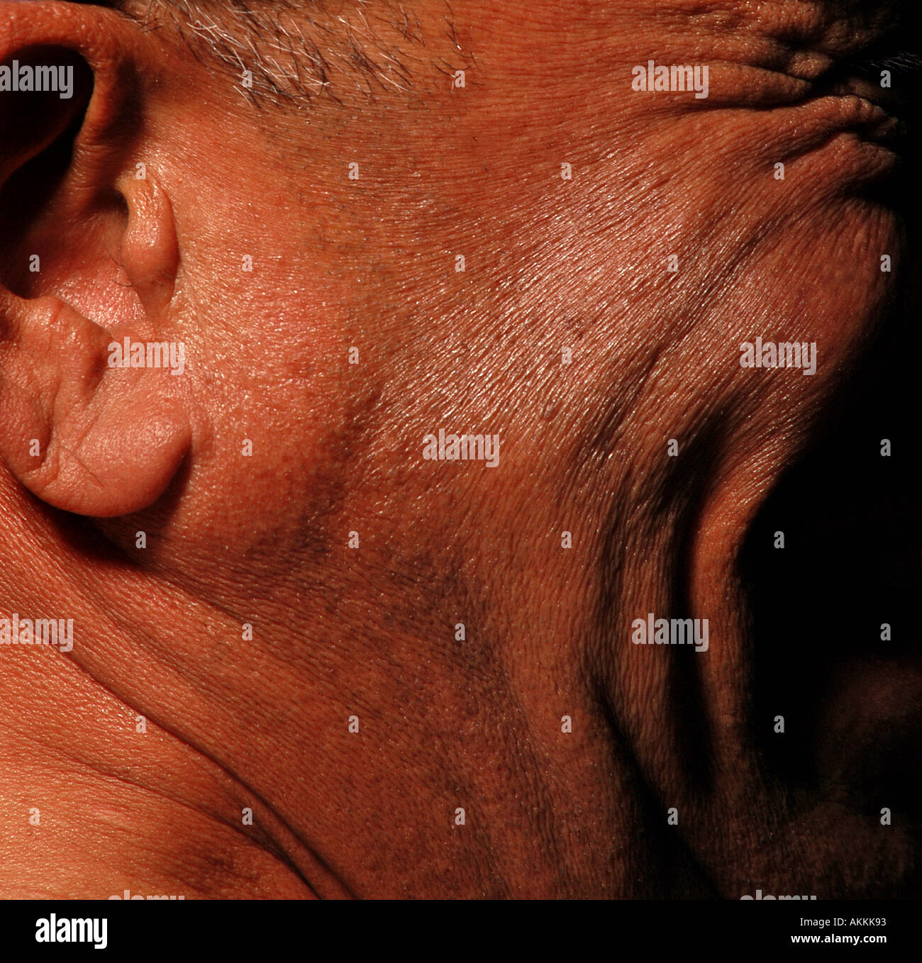 Earlobe crease hi-res stock photography and images - Alamy