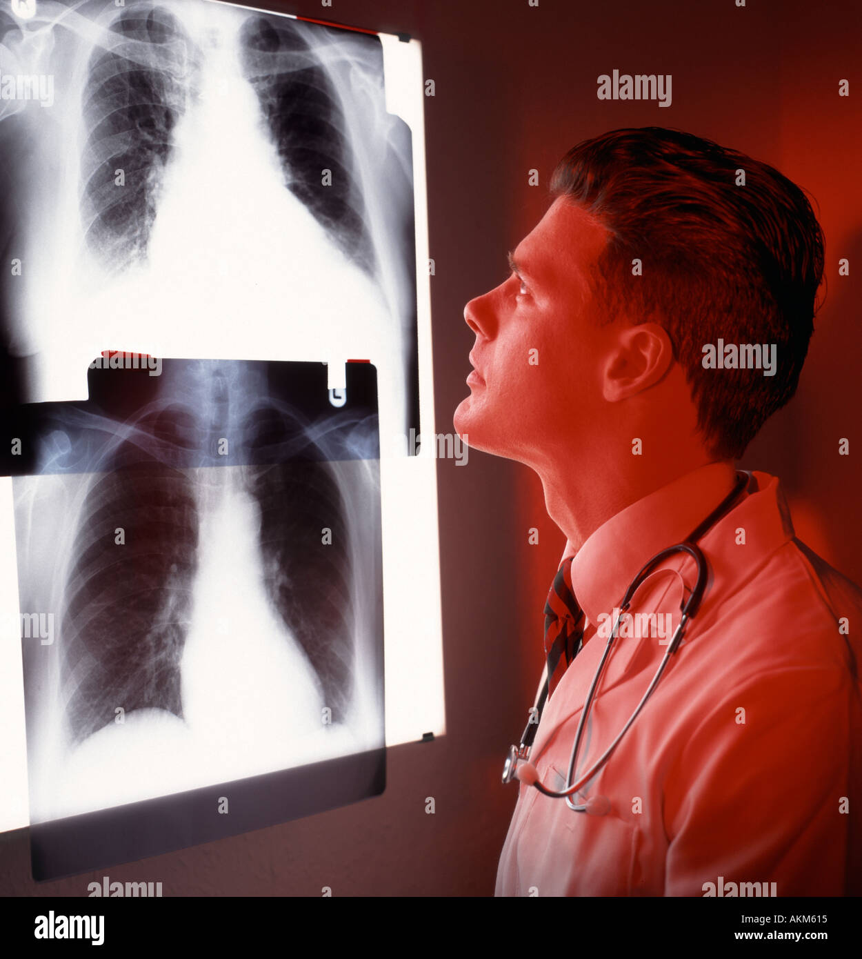 DOCTOR CHECKING X-RAYS Stock Photo - Alamy