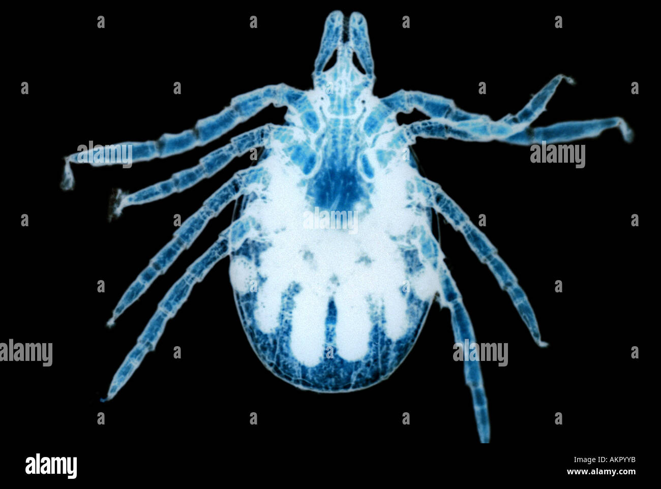 Ticks ixodes hi-res stock photography and images - Alamy