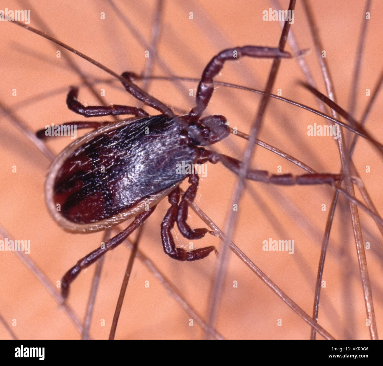 Black legged tick hi-res stock photography and images - Alamy