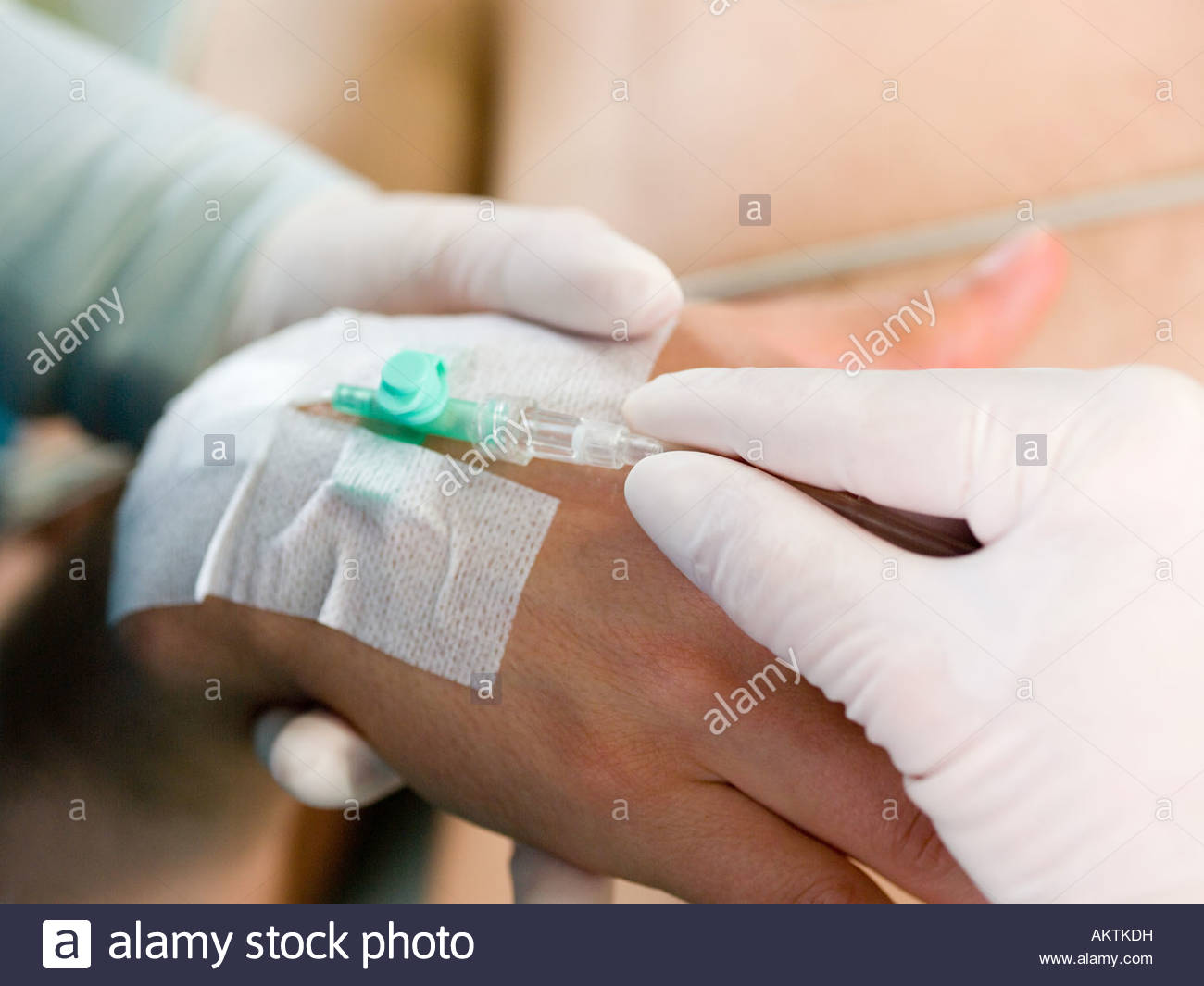 Iv Drips Stock Photos & Iv Drips Stock Images - Alamy