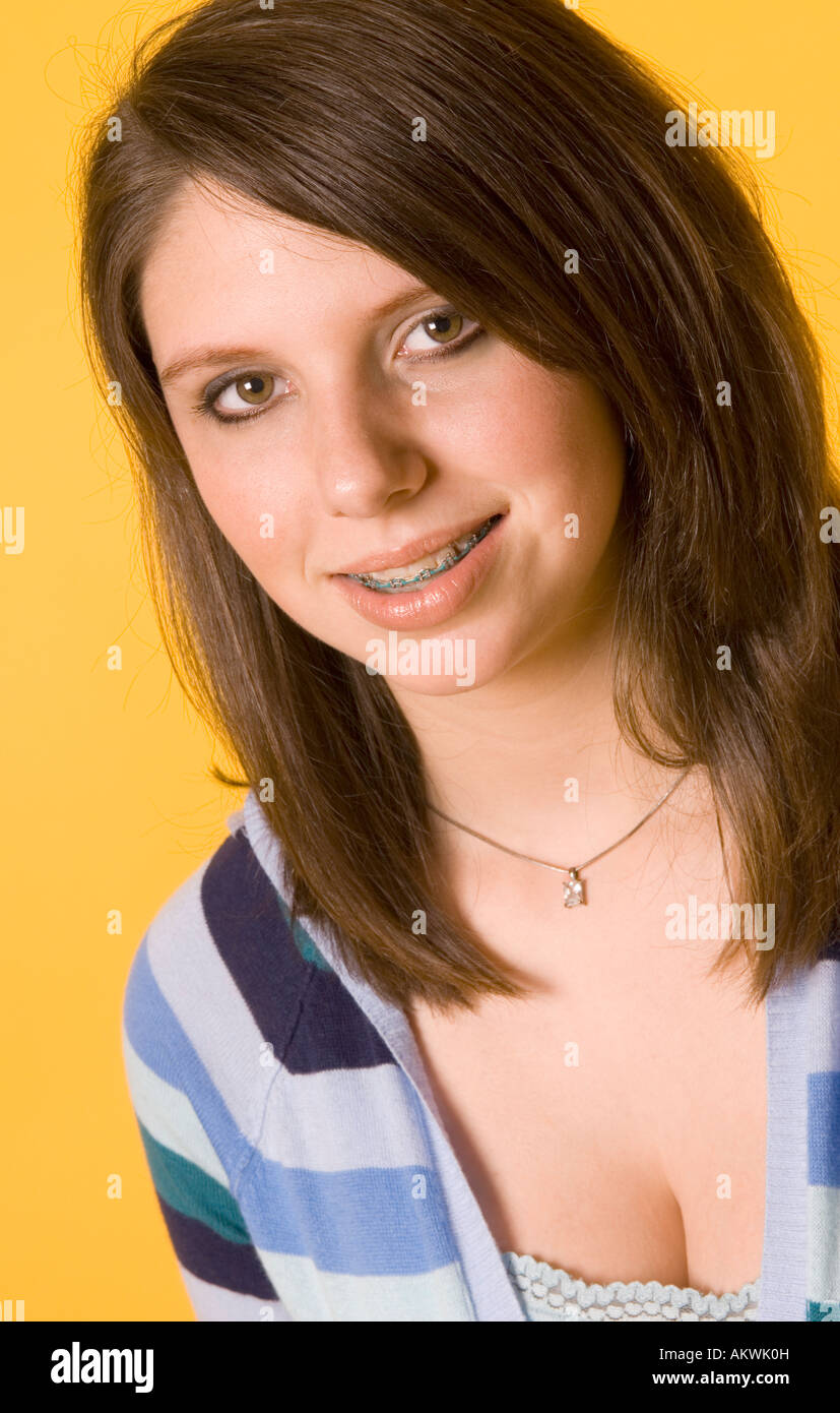 Closeup of Smiling Caucasian Teen Girl (15-17) Wearing Braces USA Stock ...