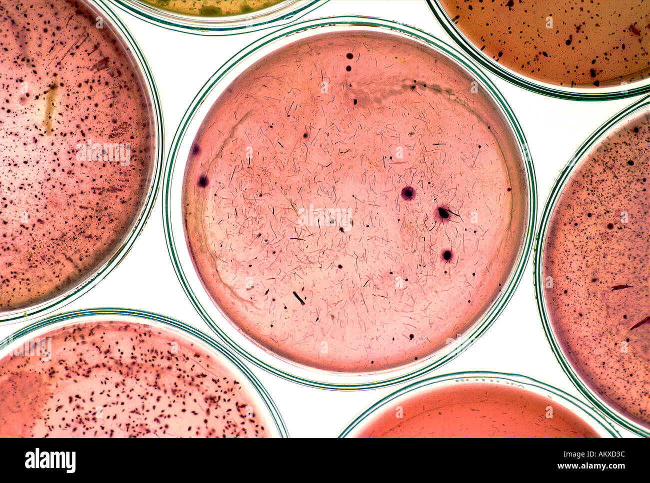 Coliform Bacteria High Resolution Stock Photography and Images - Alamy