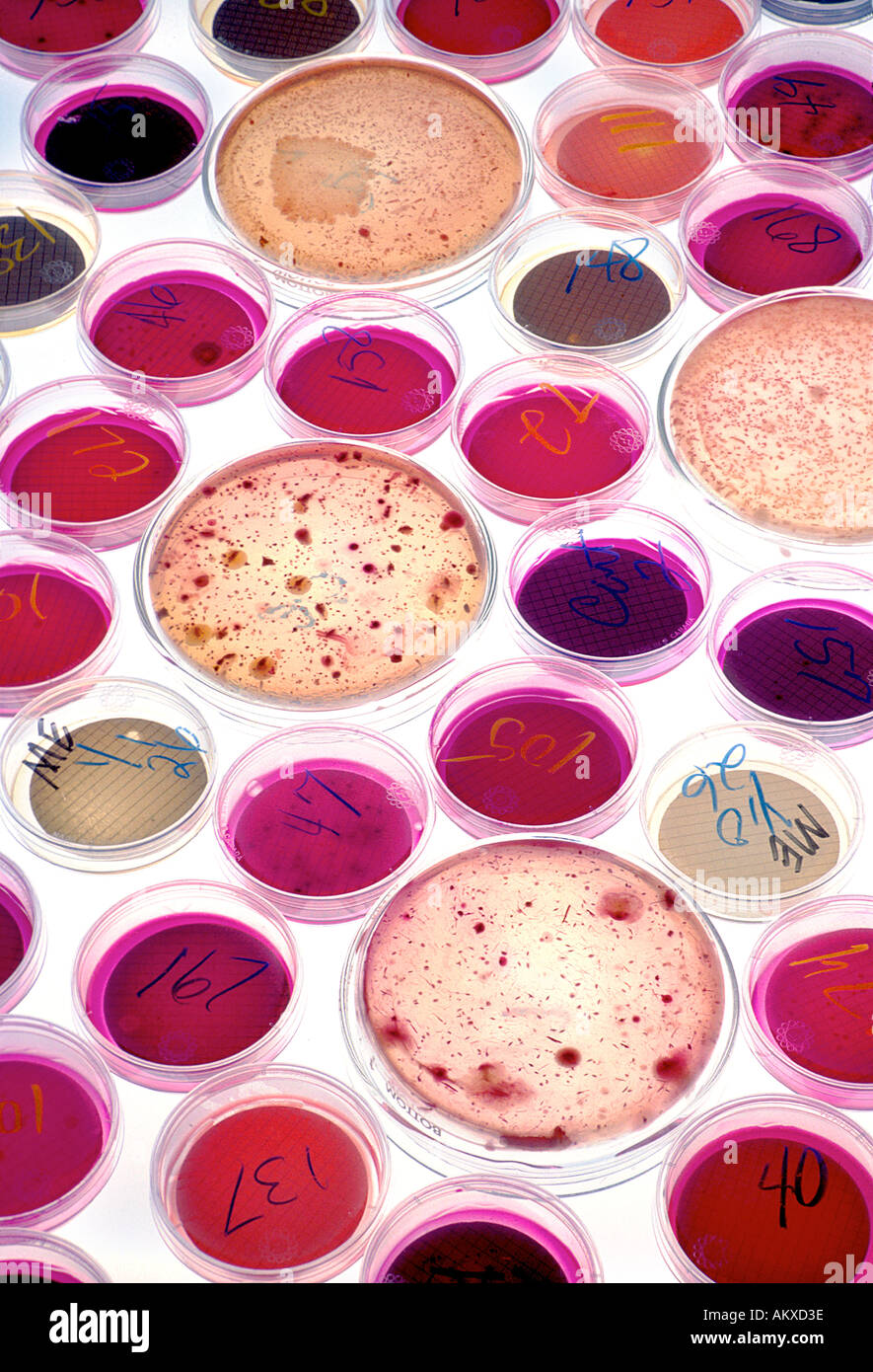 Coliform bacteria hi-res stock photography and images - Alamy