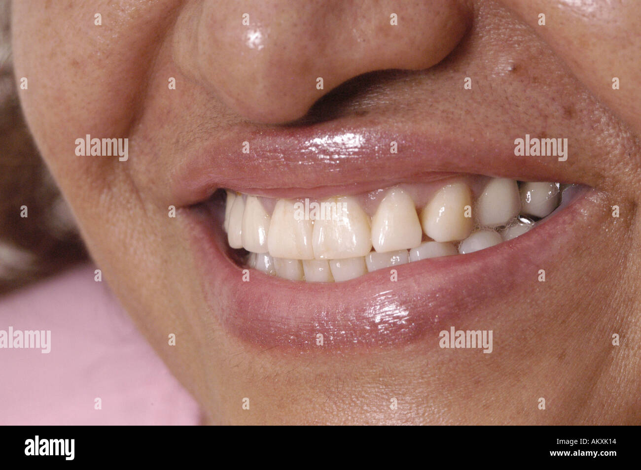 Lower face and lips Stock Photo - Alamy
