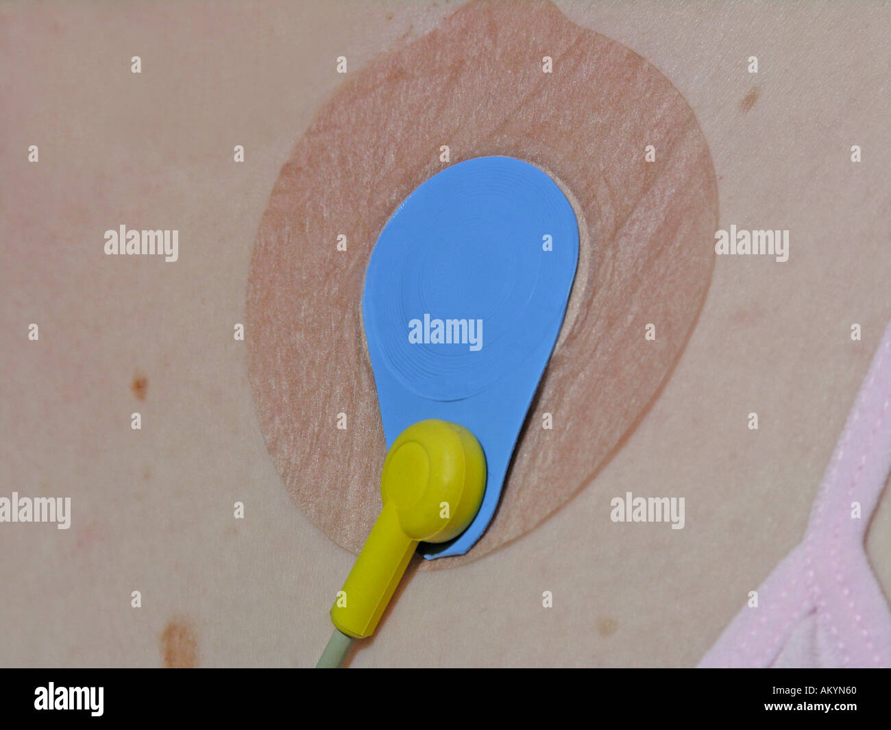 an ecg 24 hour event recorder unit called a 24 hour tape with one of ...