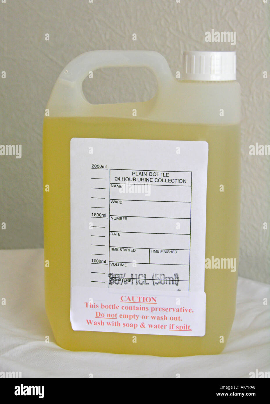24 hour urine collection container for VMA estimation for testing in ...
