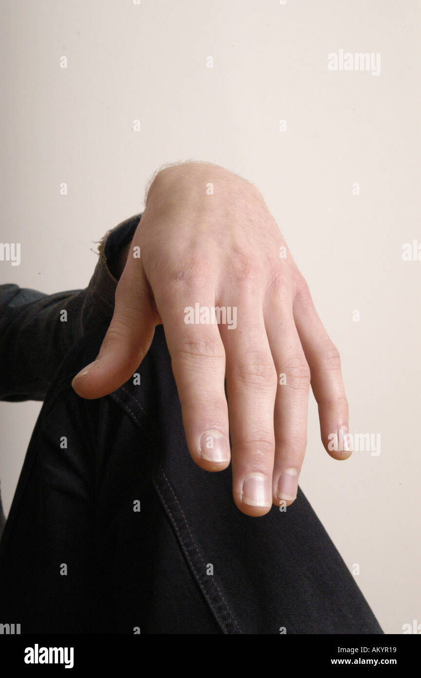 hands fingers dexterity manual skin rheumatism arthritis pain joints ...