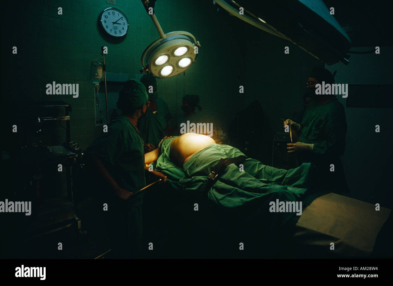 Woman lying on operating table hi-res stock photography and images - Alamy