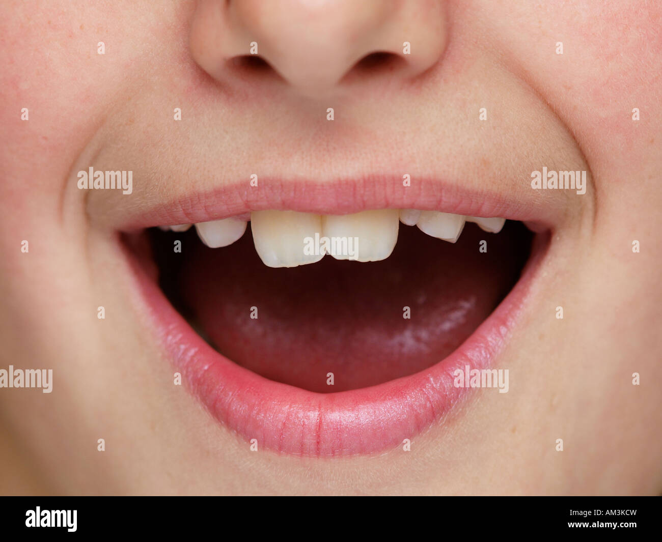 Mouth open of 11 year old girl caucasian smiling teeth happy Stock ...