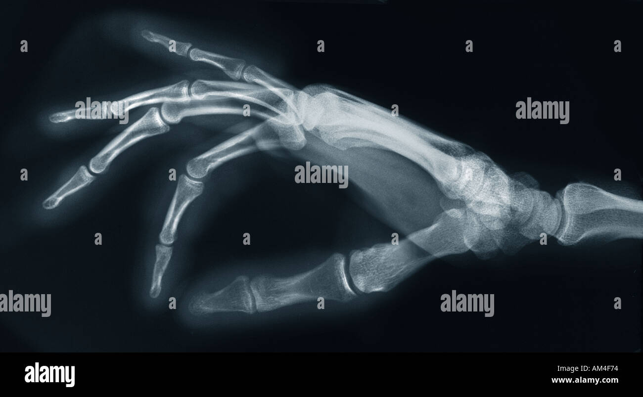 Edge x hi-res stock photography and images - Alamy