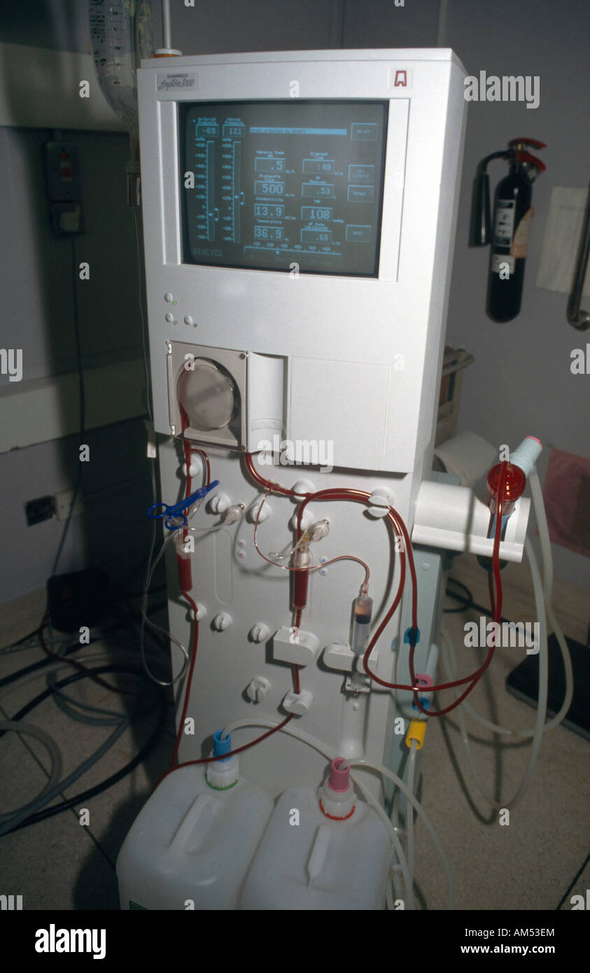 Athin Drake Willock System 1000 Computerised Dialysis Machine Common In ...
