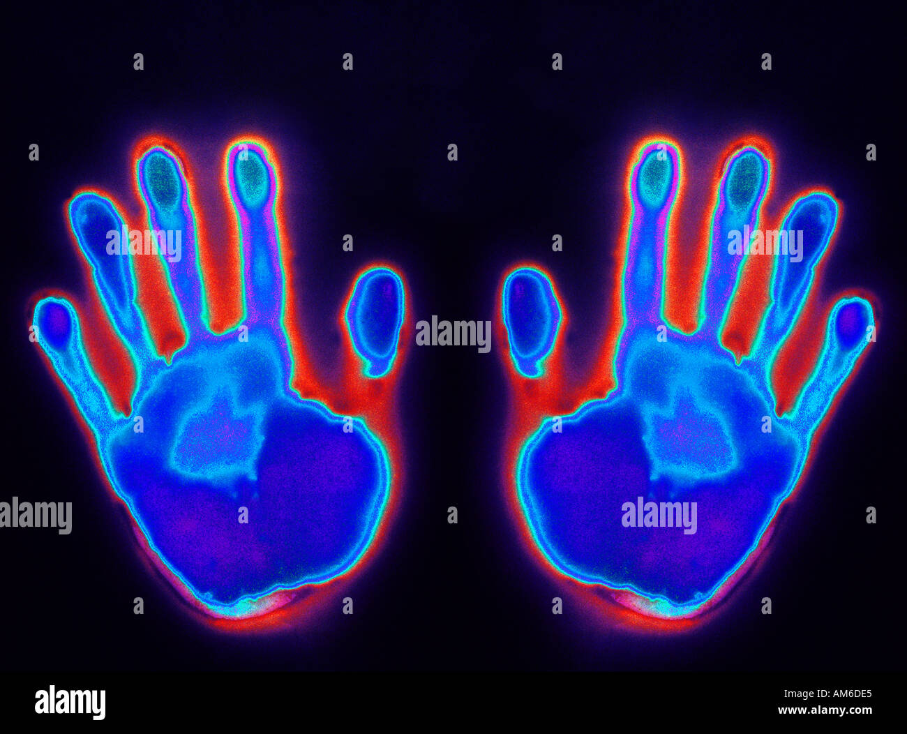 Thermal Hands II Stock Photo - Alamy