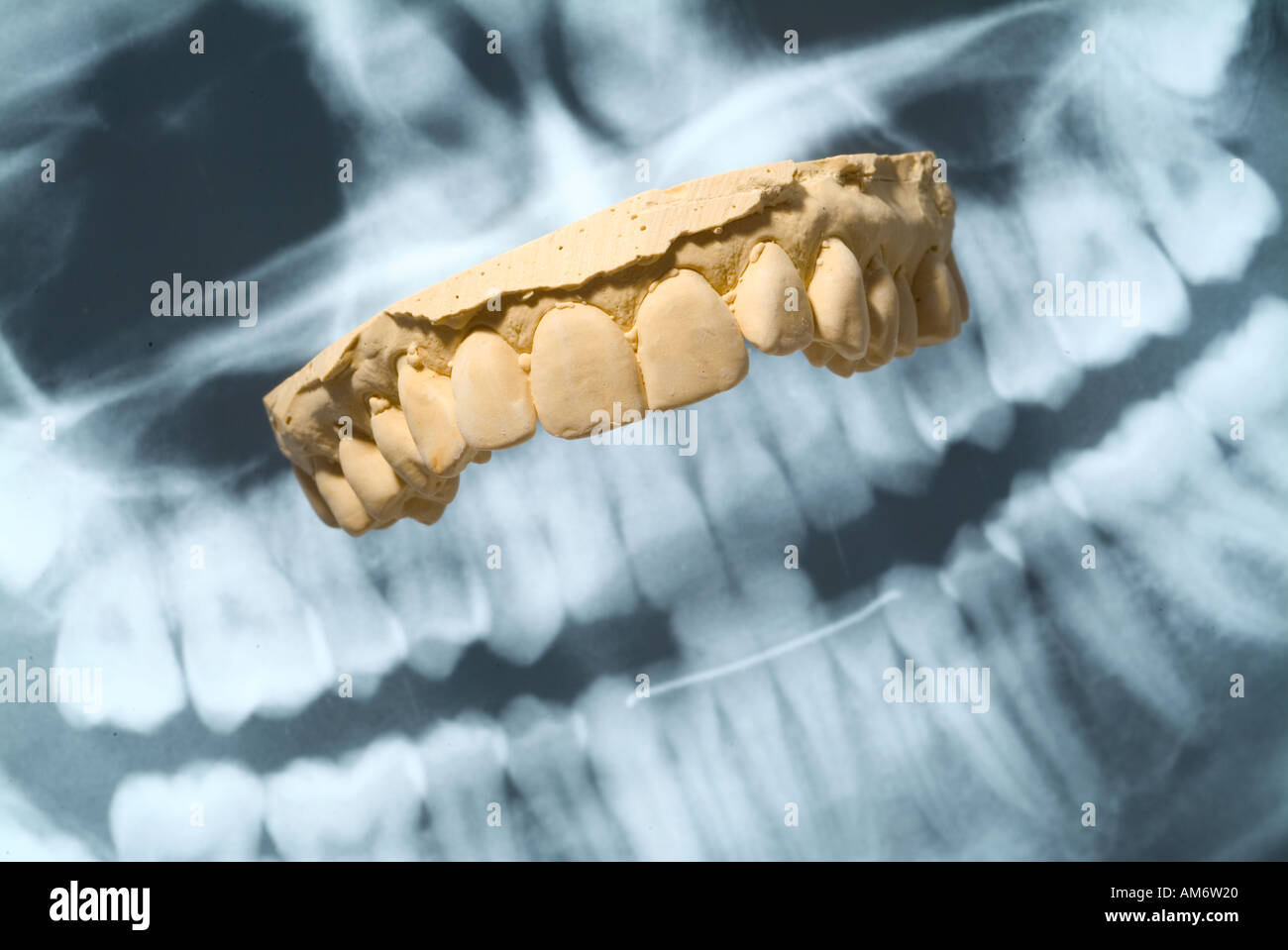 Dental x ray and mold of teeth Stock Photo - Alamy