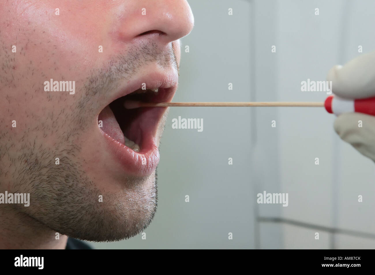 Mouth Swab Stock Photos & Mouth Swab Stock Images - Alamy